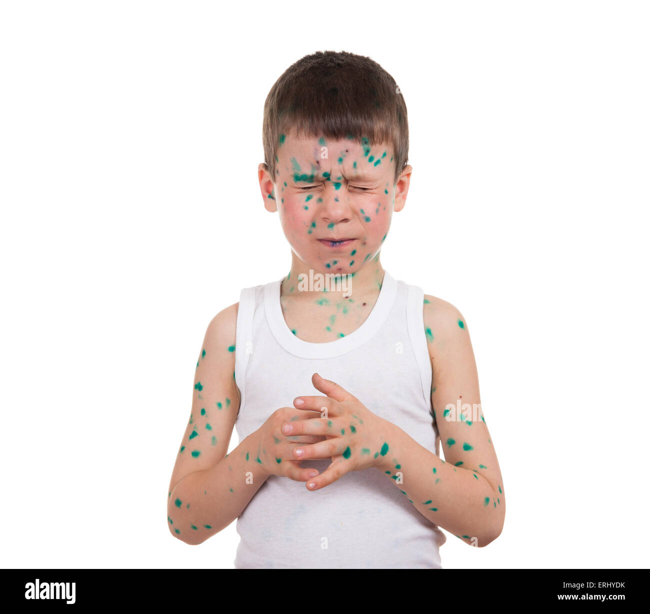 Varicelle enfant Banque de photographies et d’images à haute résolution ...