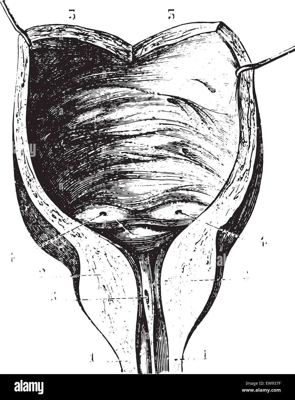 Hypertrophie prostatique Banque de photographies et d’images à haute ...