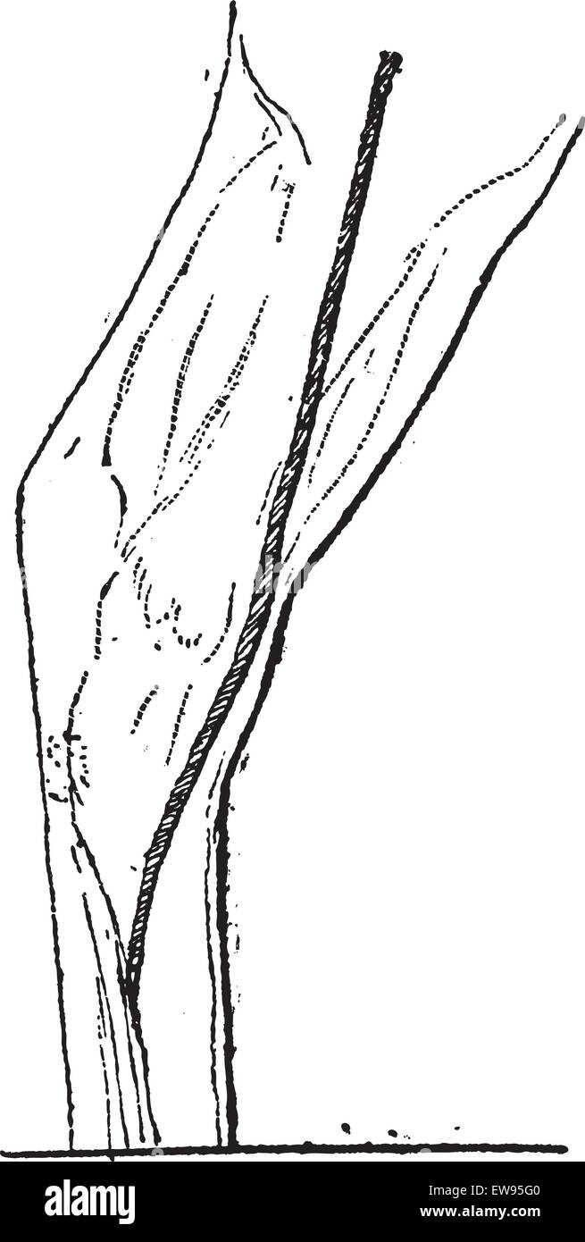 Vieille illustration gravée de grande veine saphène interne ou saphène ...