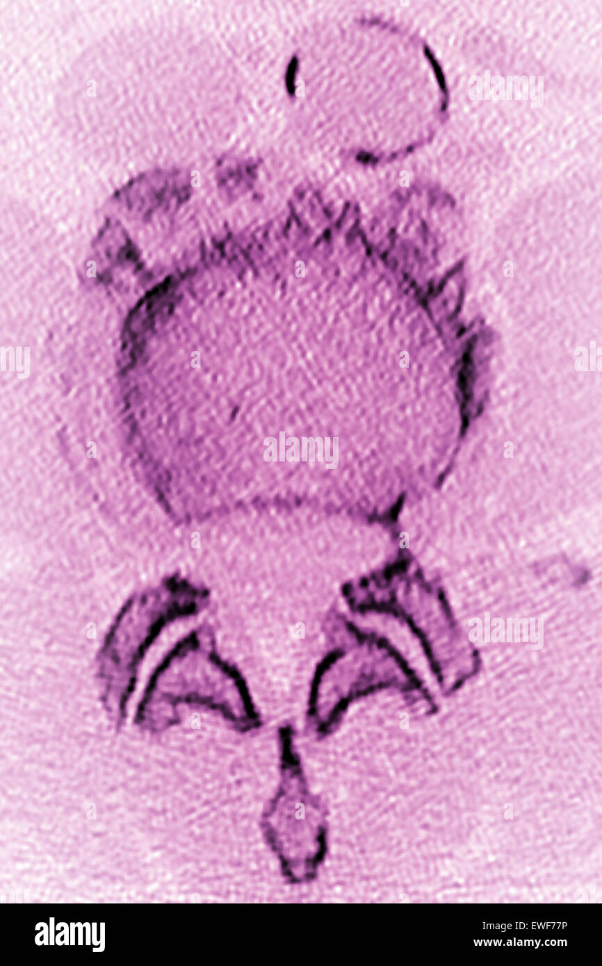 Aorte dorsale Banque de photographies et d’images à haute résolution ...