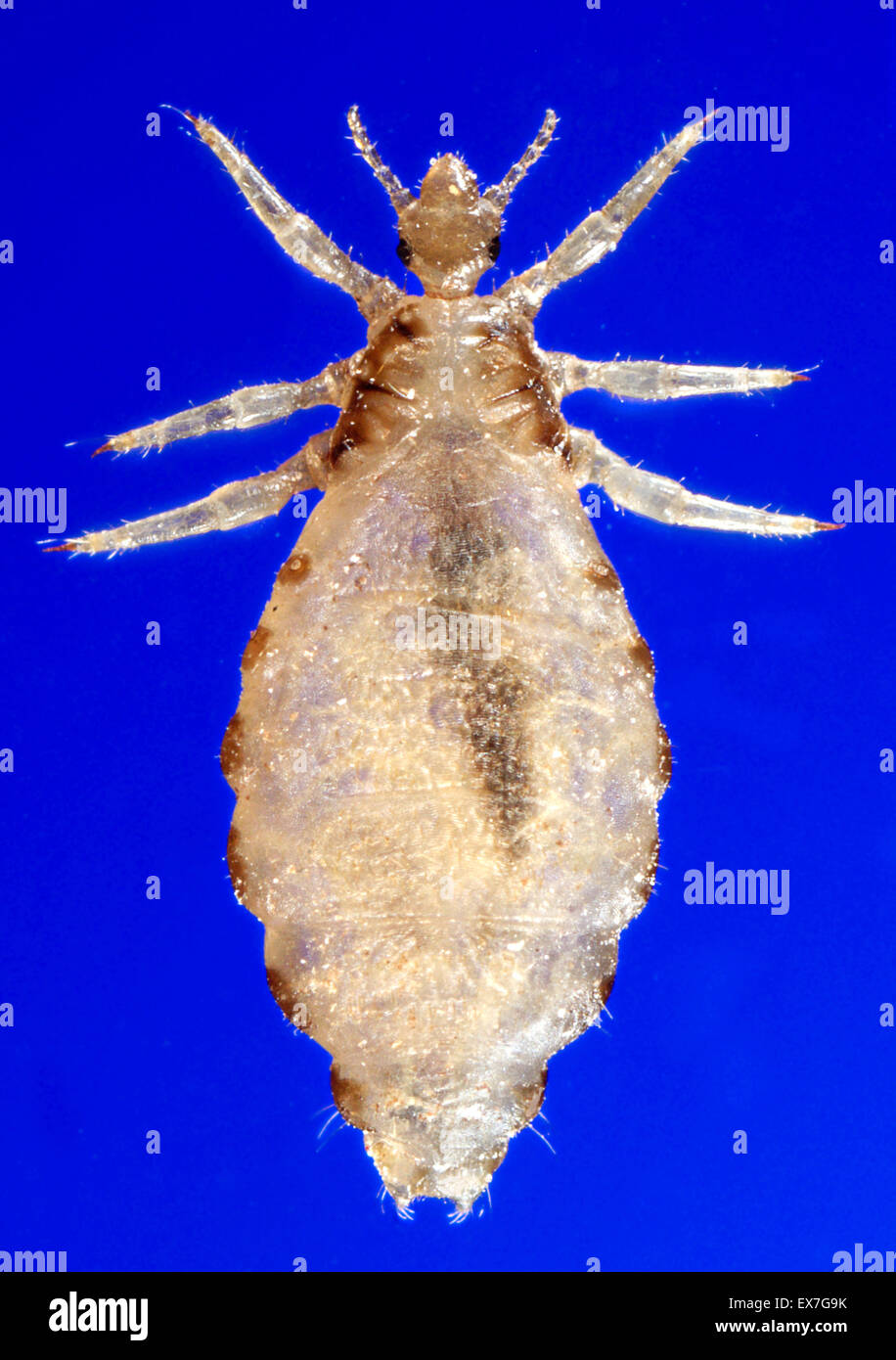 Pediculus corporis Banque de photographies et d’images à haute ...