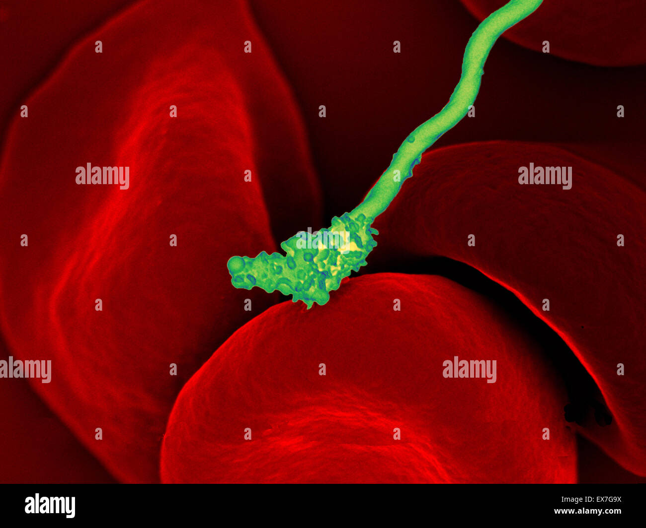 Spiral shaped bacterium Banque de photographies et d’images à haute résolution - Alamy