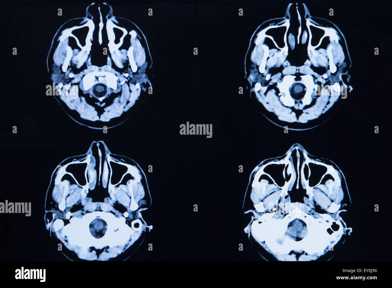 Les images d'une scanographie du cerveau et du crâne Photo Stock - Alamy