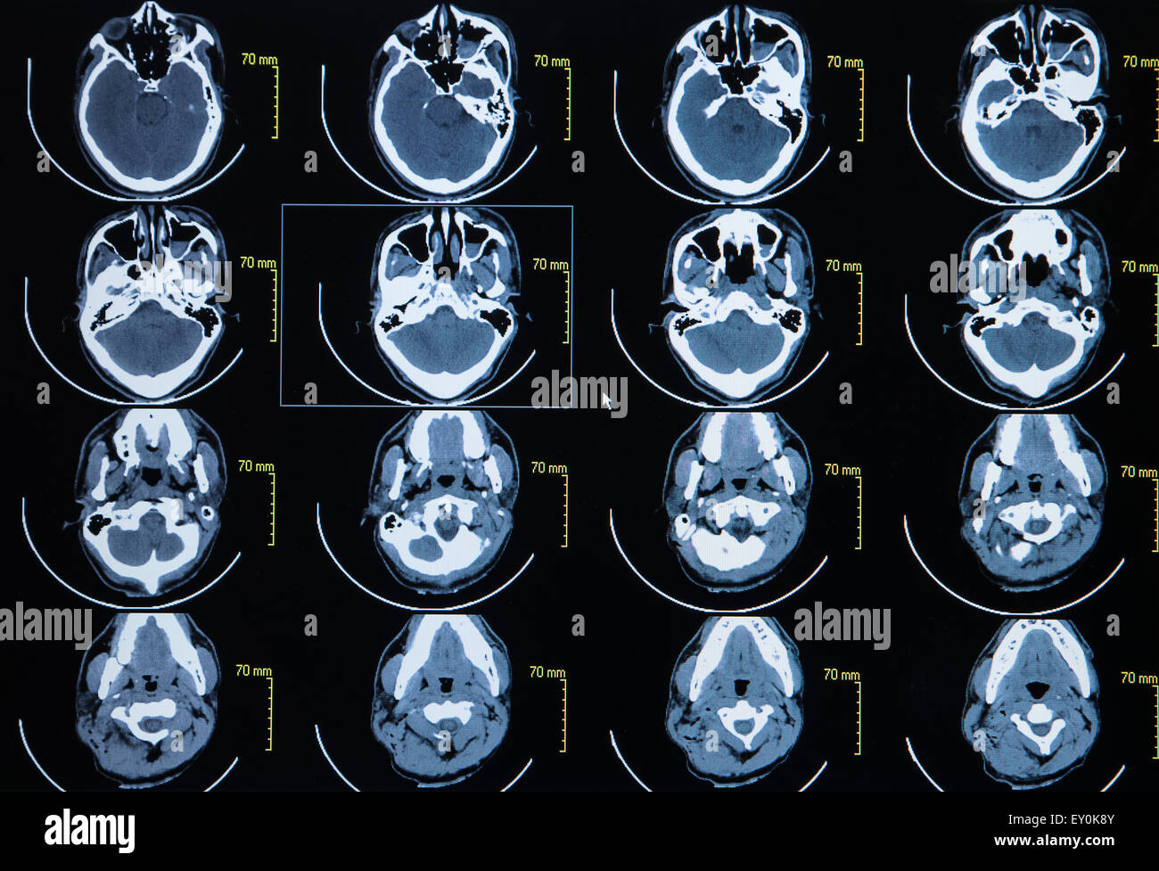 Série d'images à partir d'une scanographie du cerveau Photo Stock - Alamy