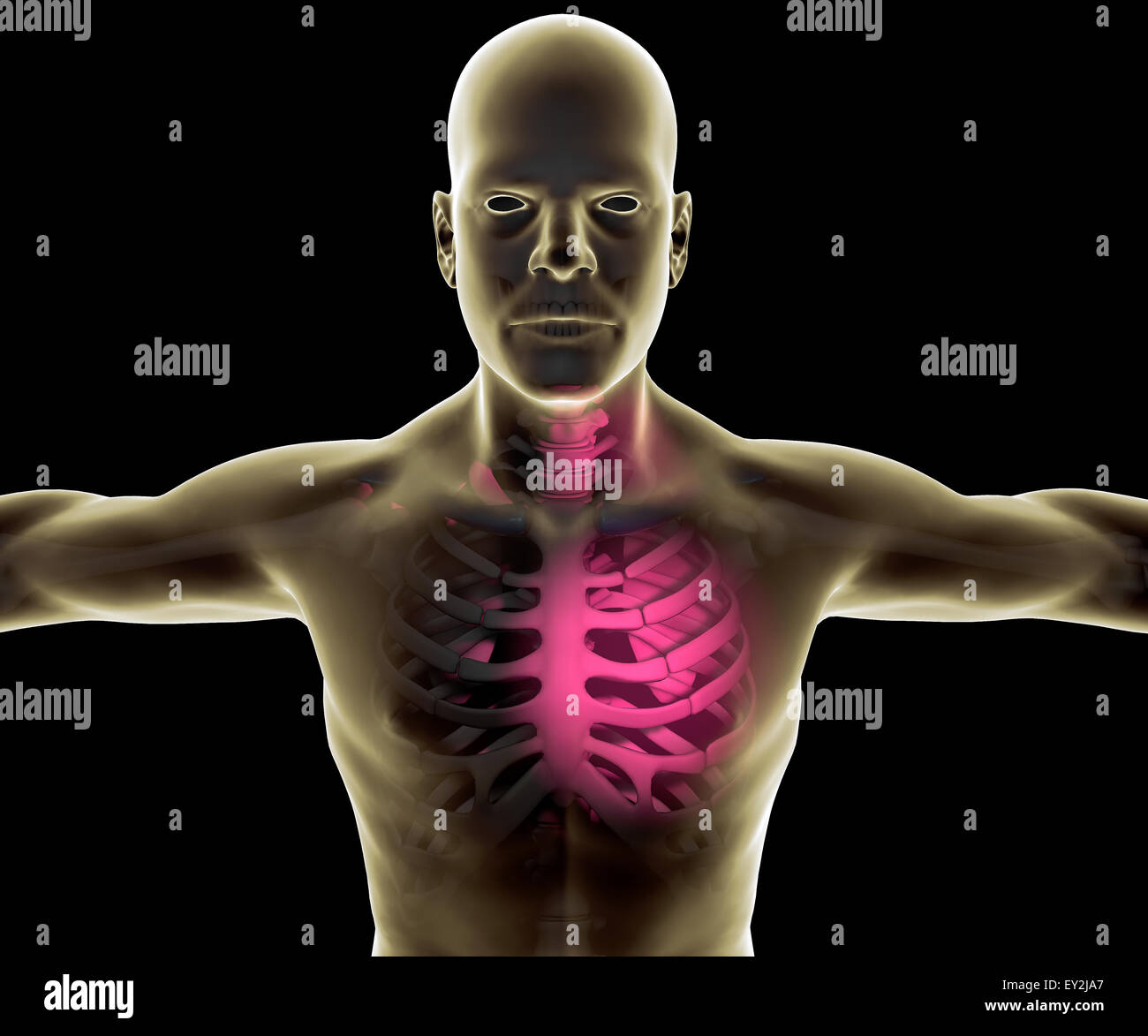 X ray du corps humain et le squelette, les douleurs cardiaques Photo ...