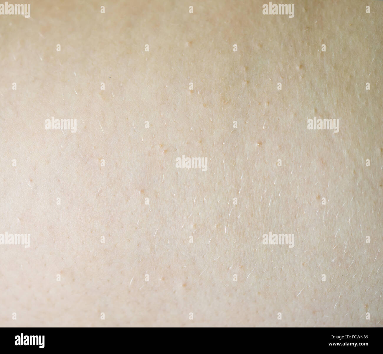Human skin texture Banque de photographies et d’images à haute ...