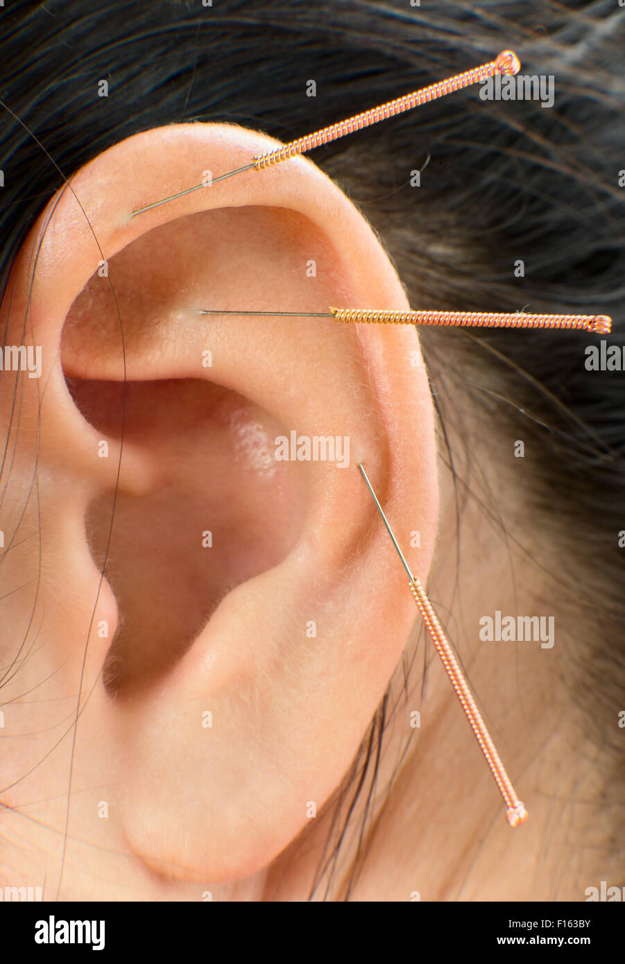 Acupuncture de l'oreille Banque d'image et photos - Alamy