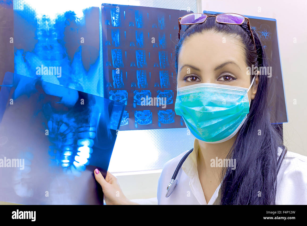 Examen aux rayons x Banque de photographies et d’images à haute ...