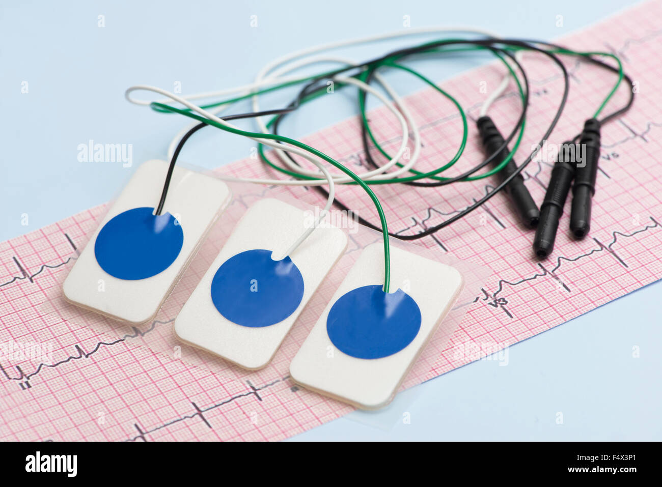 Électrocardiogramme et conduit sur l'électrocardiographe tableau bleu ...