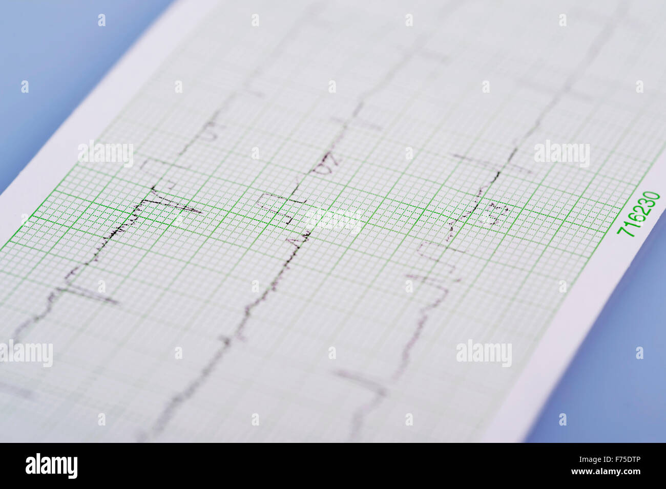Electrocardiogram ecg Banque de photographies et d’images à haute ...