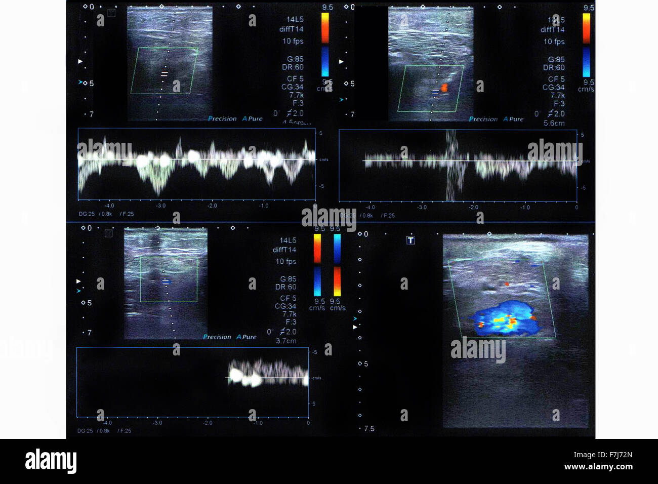 Doppler ultrasound scan Banque de photographies et d’images à haute ...