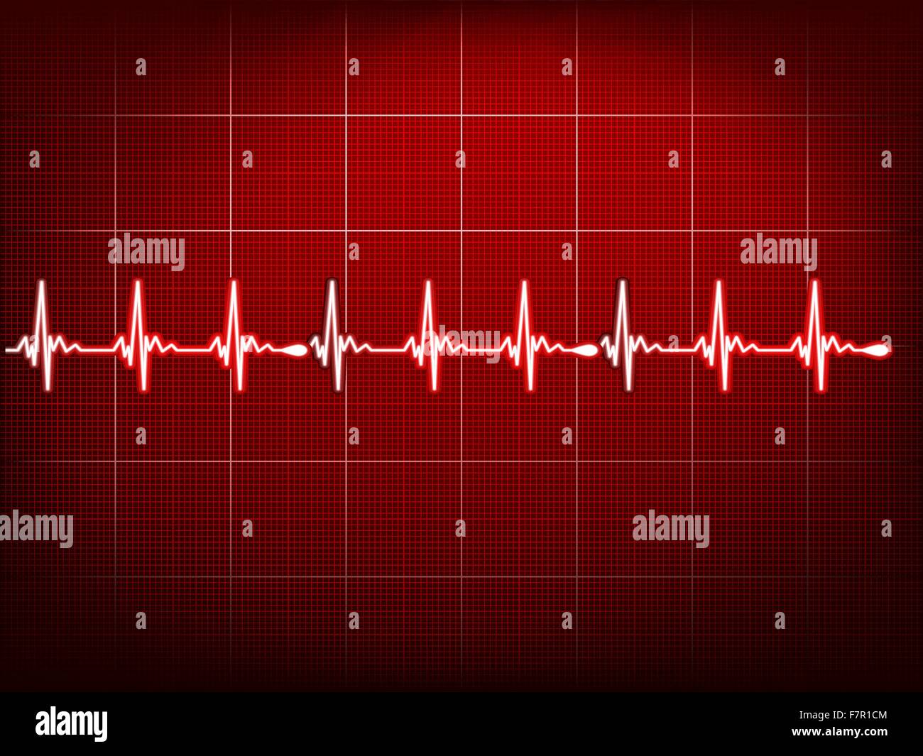 Moniteur cardiaque cardiogramme ekg Banque d'images vectorielles - Alamy