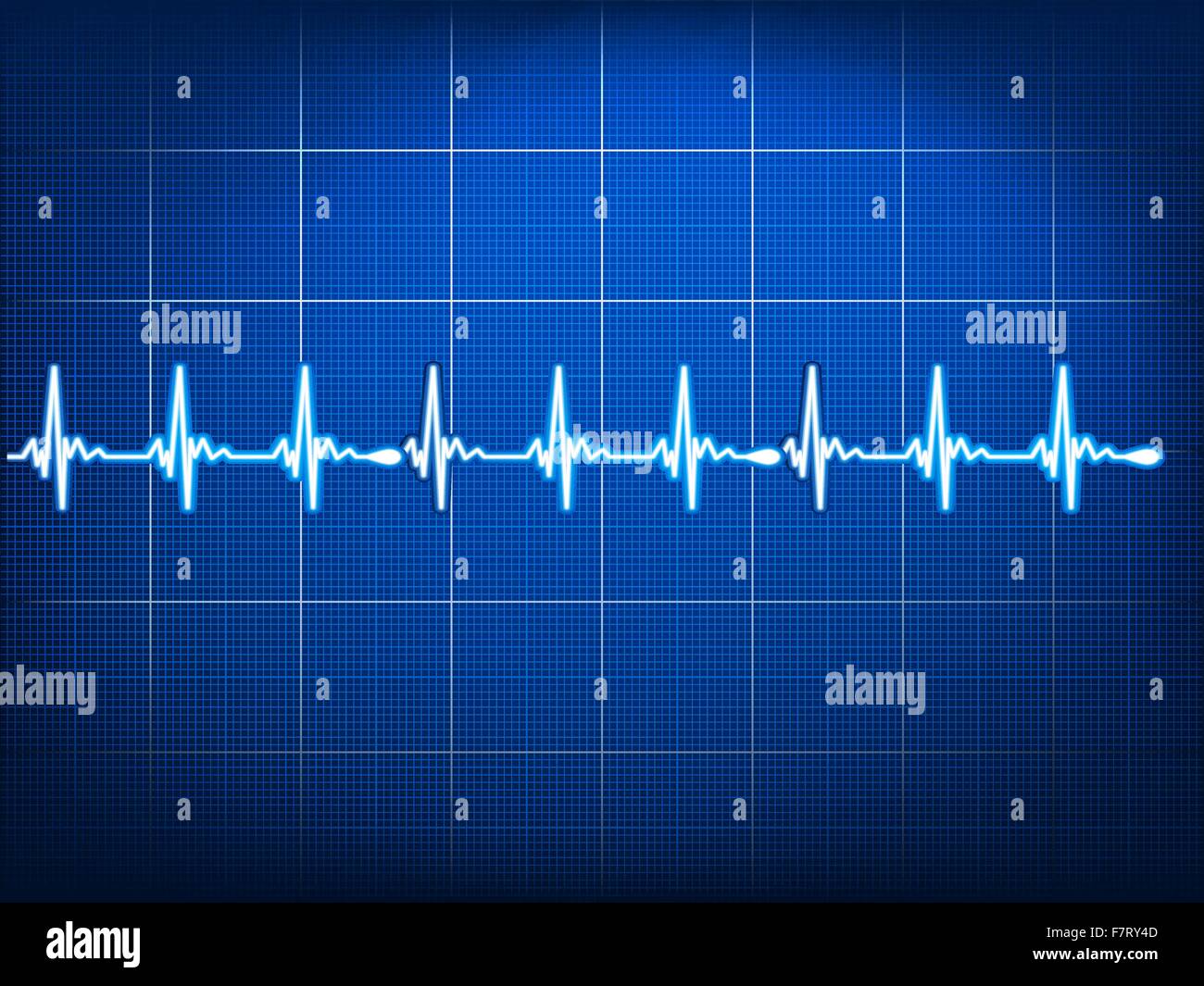 Moniteur cardiaque cardiogramme ekg Banque d'images vectorielles - Alamy