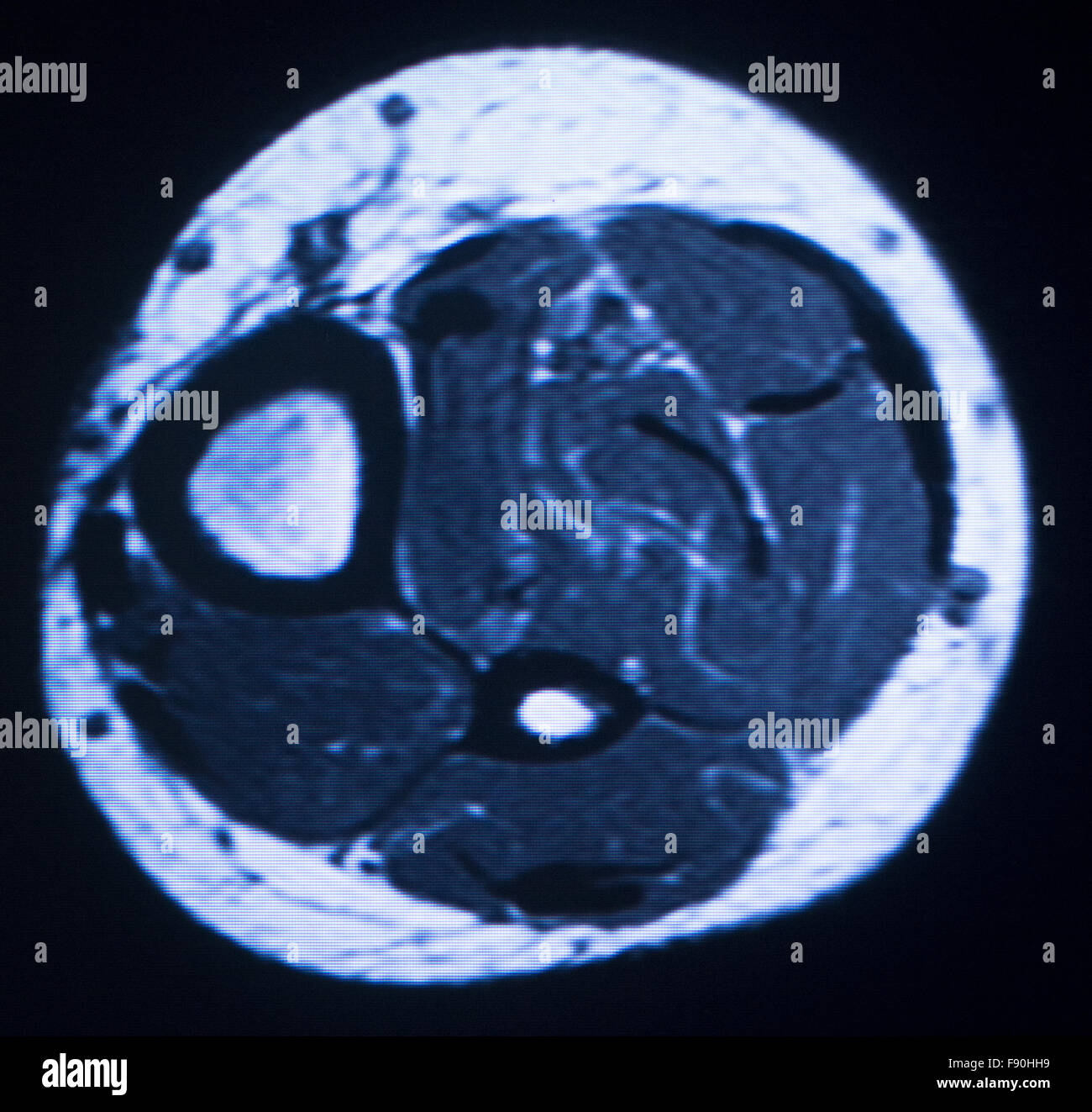 L'imagerie par résonance magnétique IRM scanner médical résultats de ...