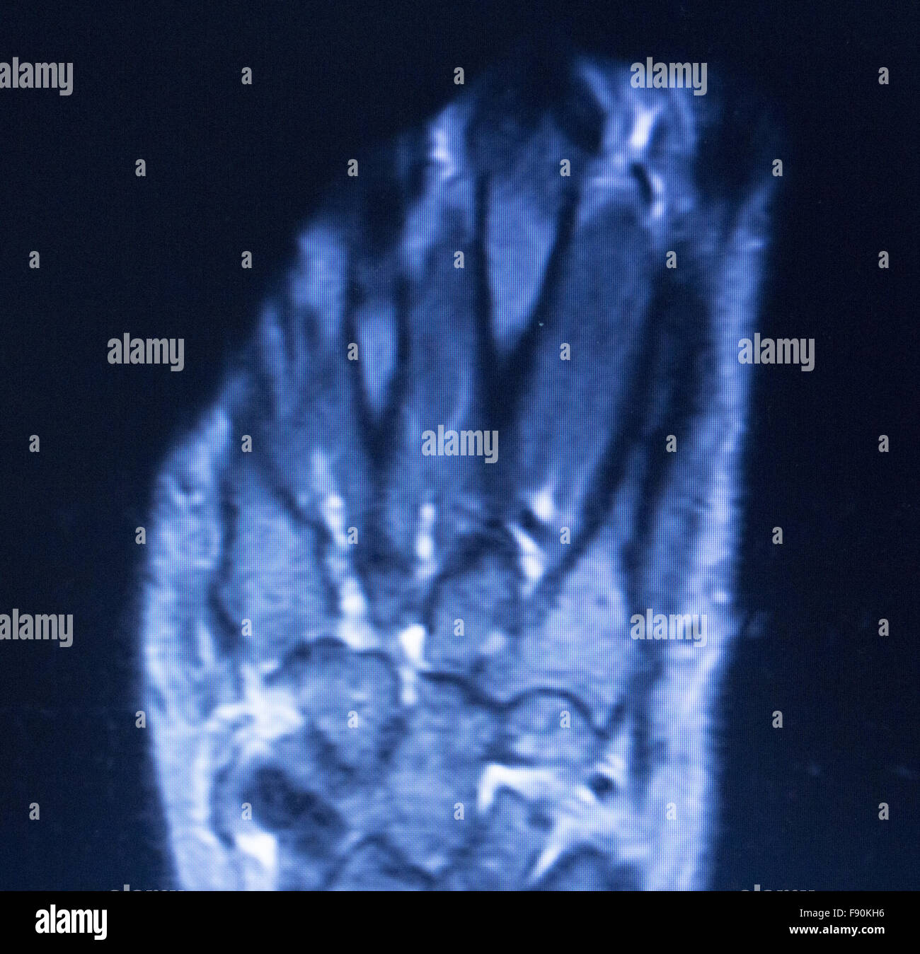 L'imagerie par résonance magnétique IRM scan test médical résultats de ...