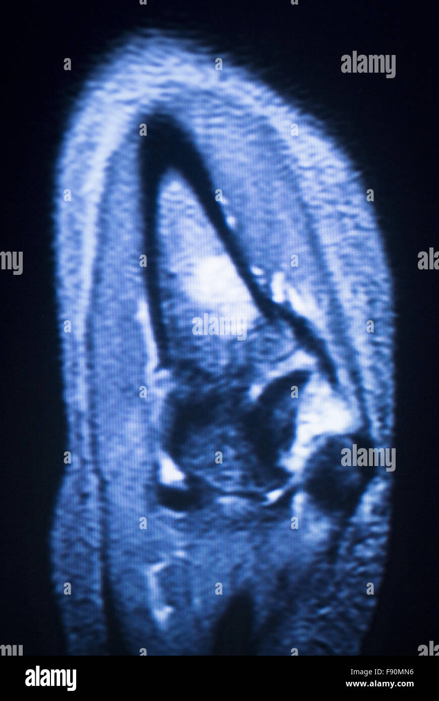 L'imagerie par résonance magnétique IRM scan test médical résultats ...