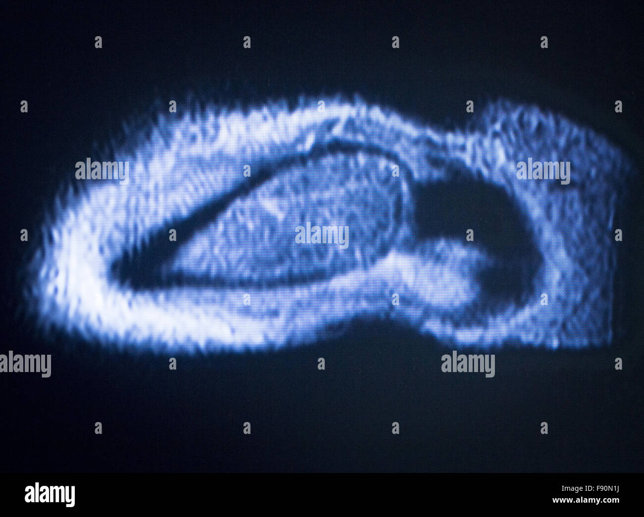 L'imagerie par résonance magnétique IRM scan test médical résultats ...