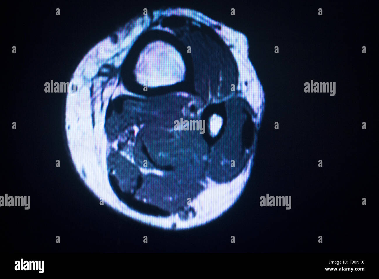 L'imagerie par résonance magnétique IRM scanner médical résultats de ...
