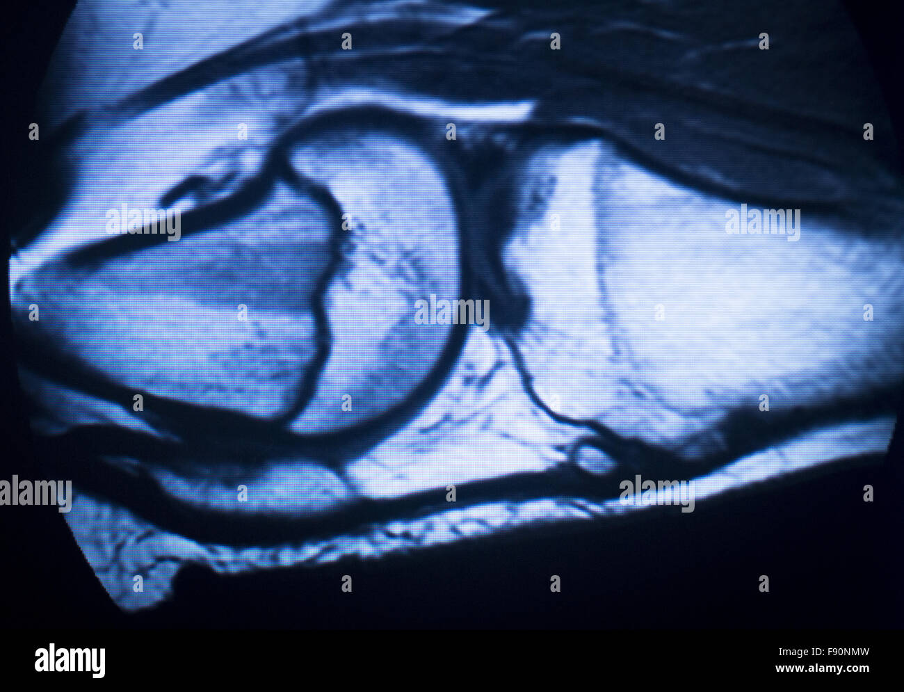 L'imagerie par résonance magnétique IRM scanner médical résultats de ...