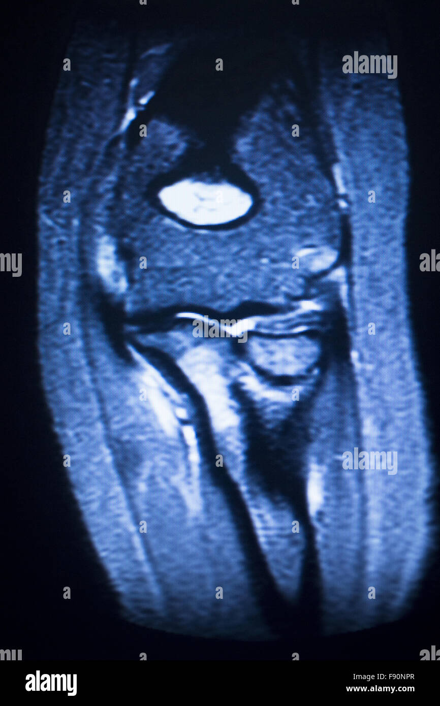 L'imagerie par résonance magnétique IRM scan test médical résultats ...