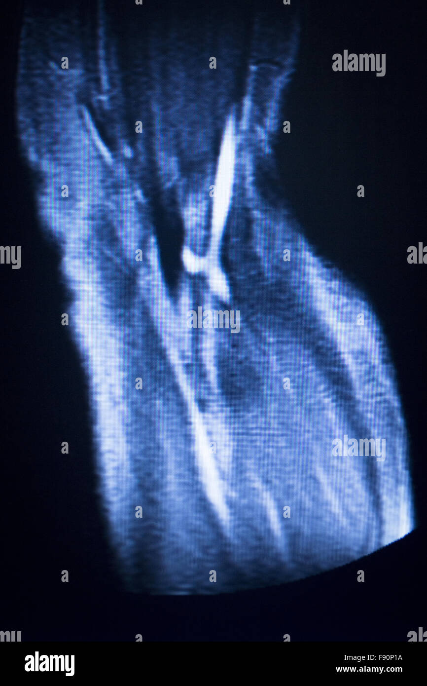 L'imagerie par résonance magnétique IRM scan test médical résultats ...