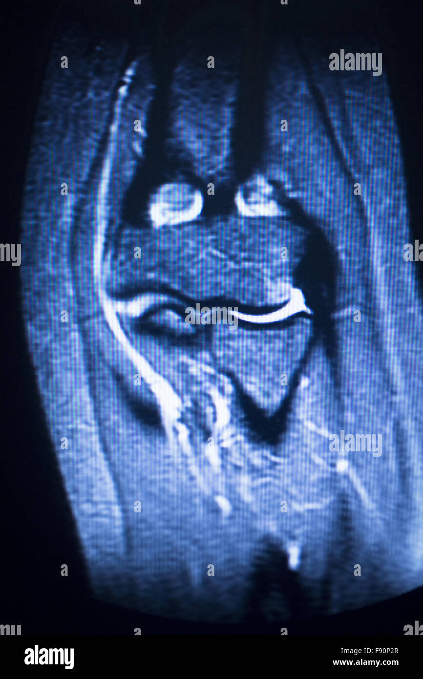 L'imagerie par résonance magnétique IRM scan test médical résultats ...