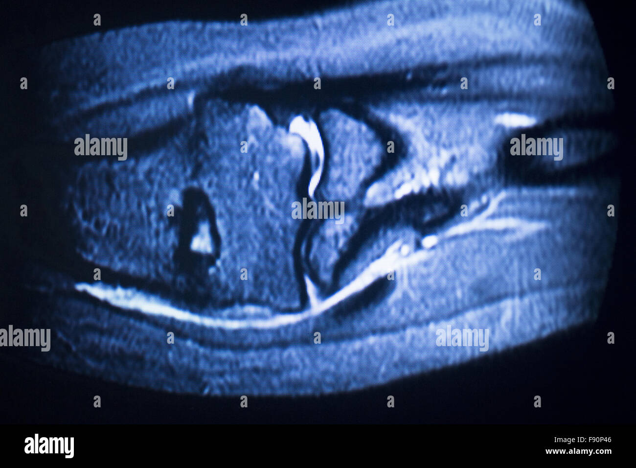 L'imagerie par résonance magnétique IRM scan test médical résultats ...