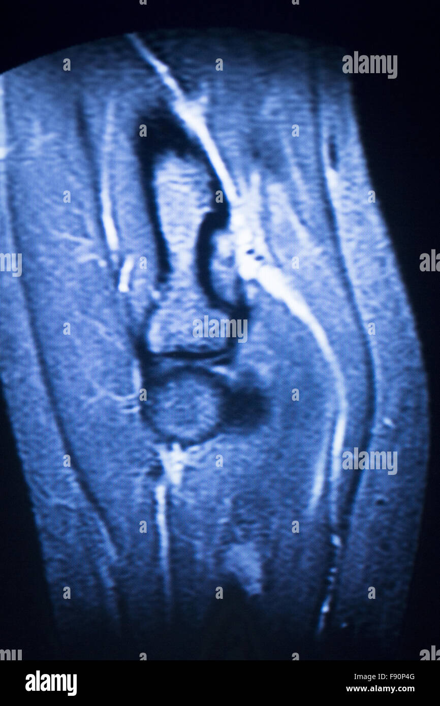 L'imagerie par résonance magnétique IRM scan test médical résultats ...