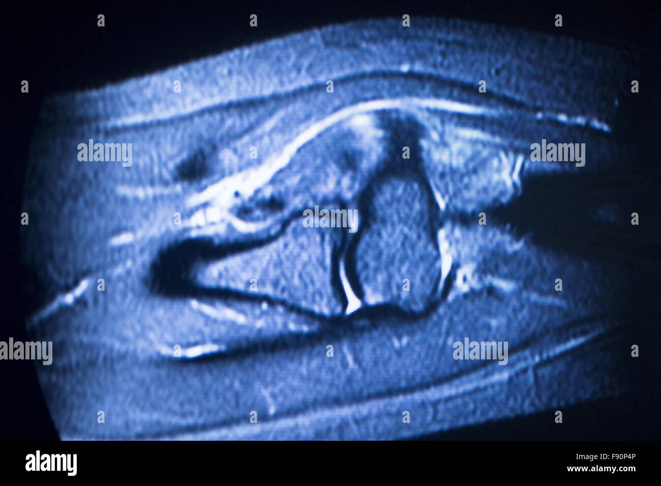 L'imagerie par résonance magnétique IRM scan test médical résultats ...