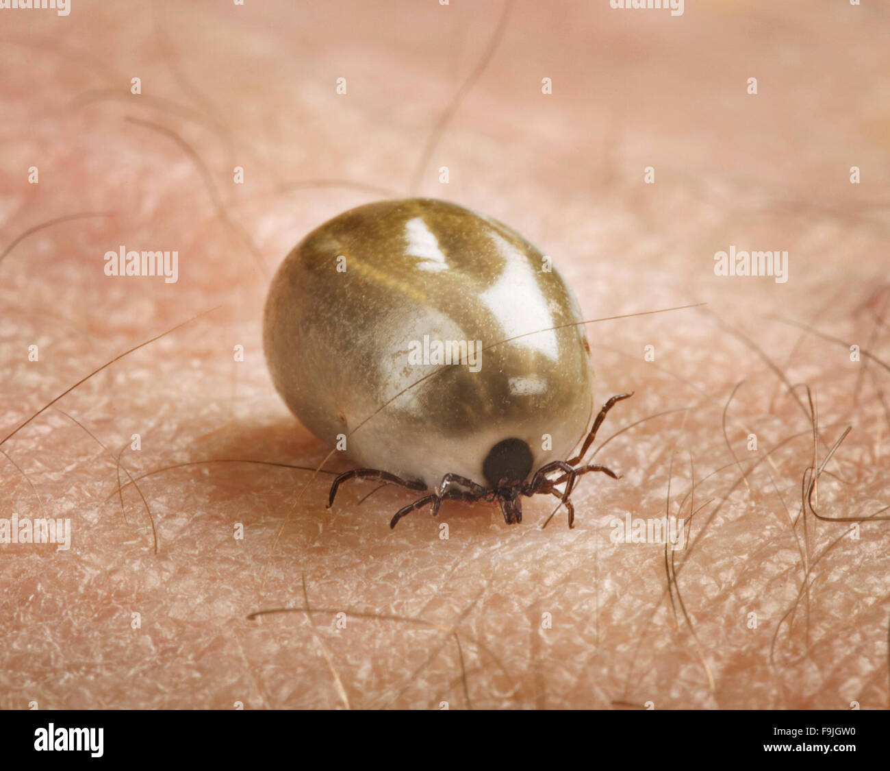 Tique se nourrissant d'humain Banque d'image et photos - Alamy