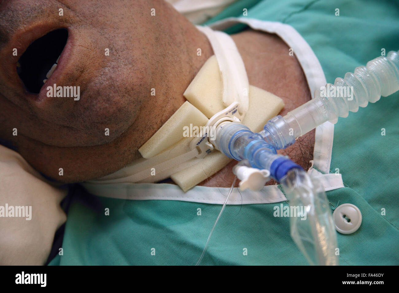 Patient qui a subi une trachéotomie sur la forte dépendance, de l'unité ...
