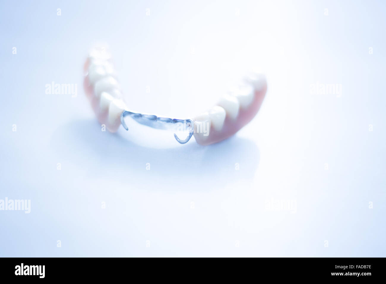 La prothèse partielle amovible en plastique et métal de fausses dents ...