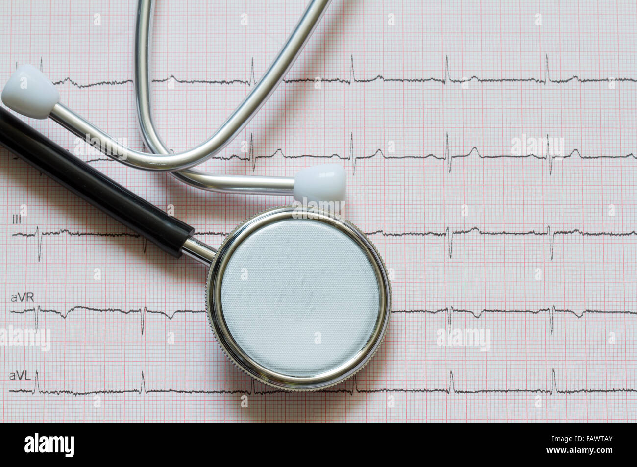 Diagramme de cardiogramme Banque de photographies et d’images à haute ...
