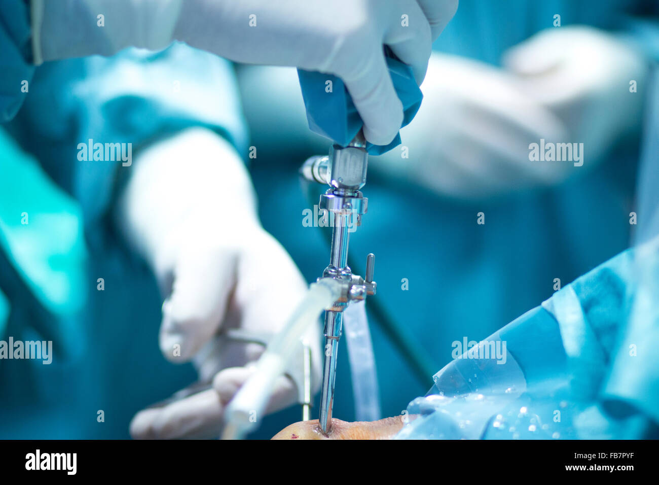 Chirurgie du genou orthopédie traumatologie opération chirurgicale de l ...