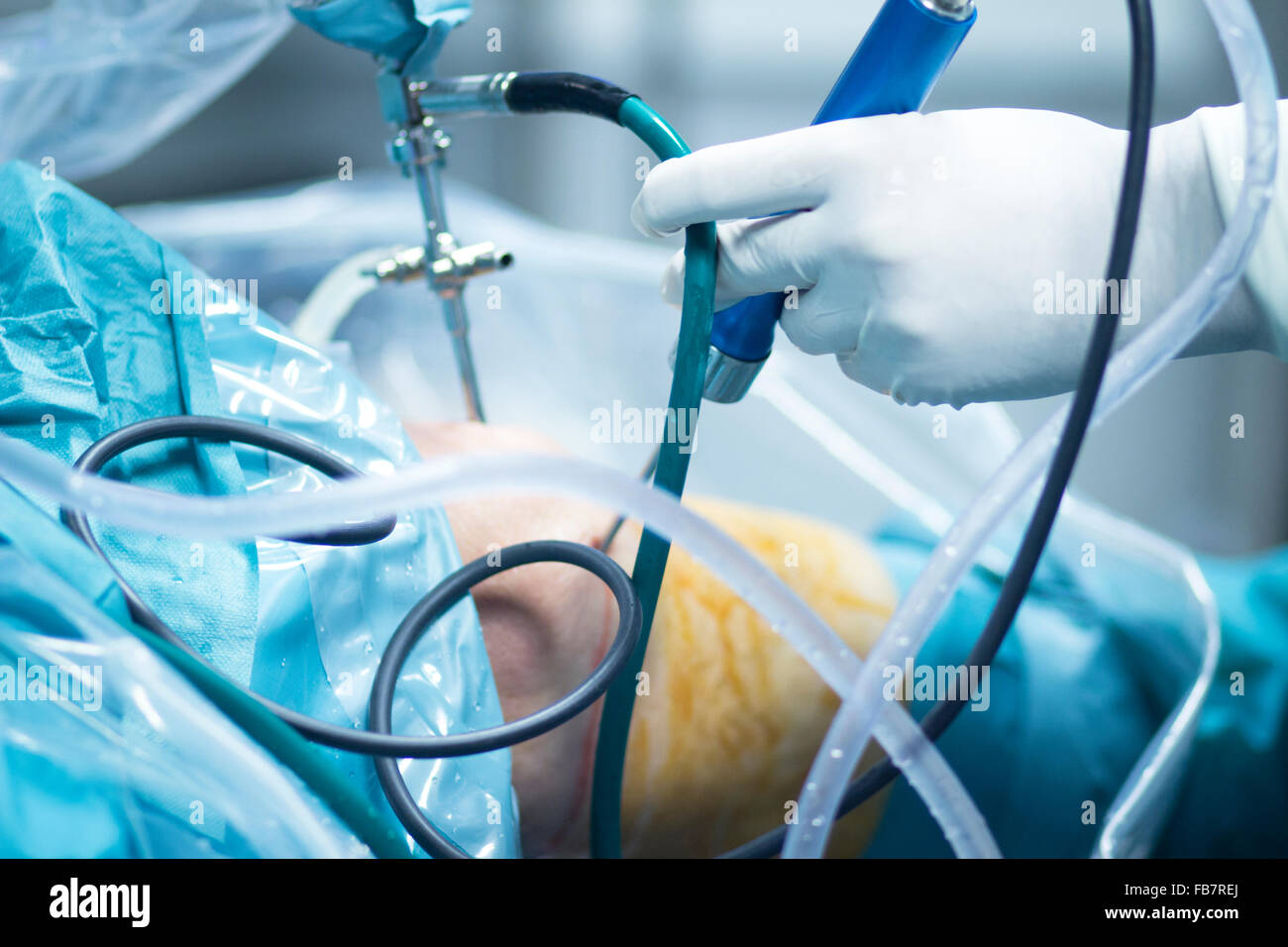 Chirurgie du genou orthopédie traumatologie opération chirurgicale de l ...