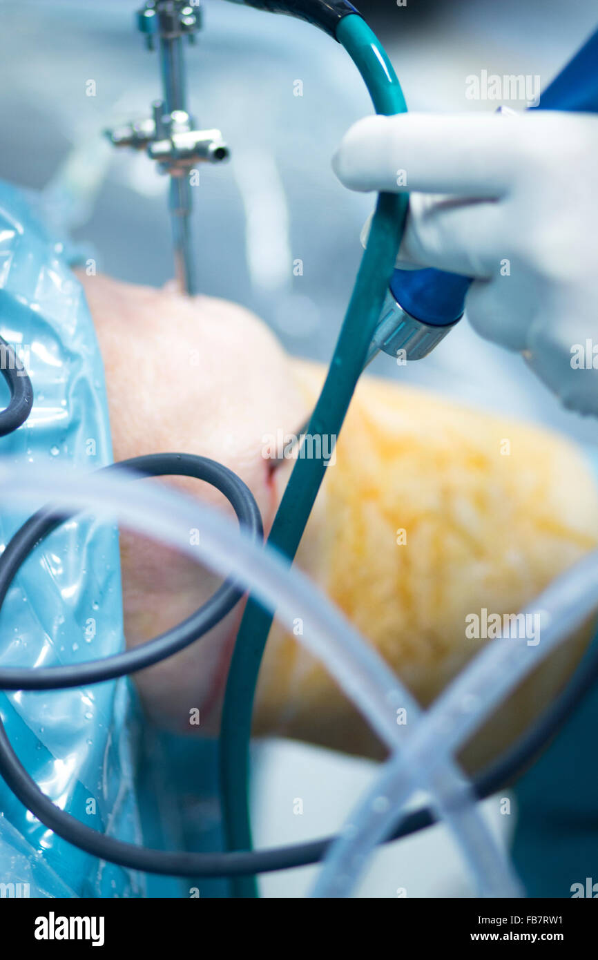 Chirurgie du genou orthopédie traumatologie opération chirurgicale de l ...