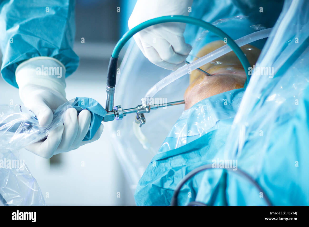 Chirurgie du genou orthopédie traumatologie opération chirurgicale de l ...