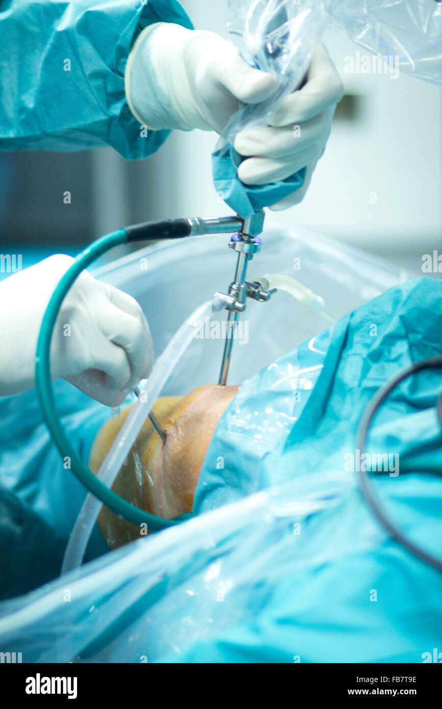 Chirurgie du genou orthopédie traumatologie opération chirurgicale de l ...