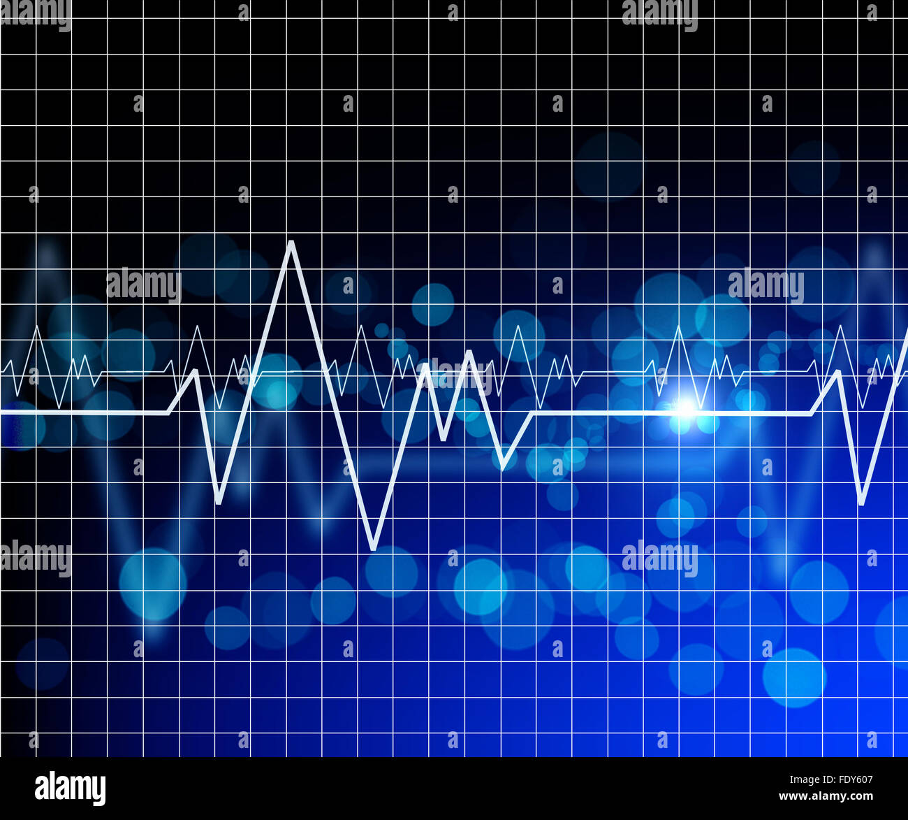 Electrocardiograma en monitor Banque de photographies et d’images à ...