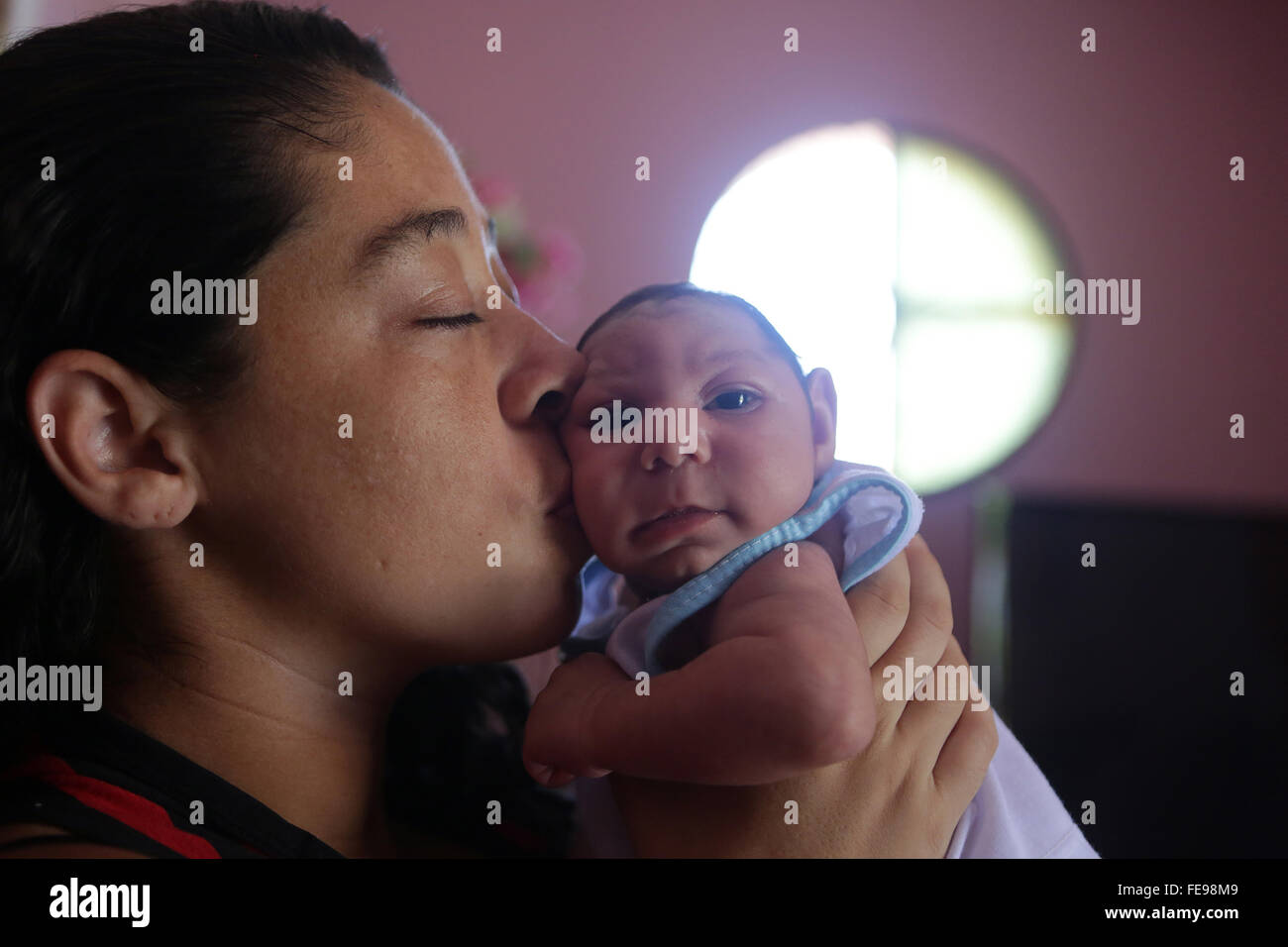Microcephaly baby Banque de photographies et d’images à haute ...