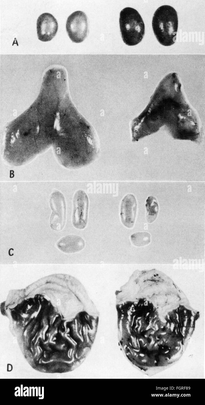 Medicines 1950s Banque de photographies et d’images à haute résolution ...