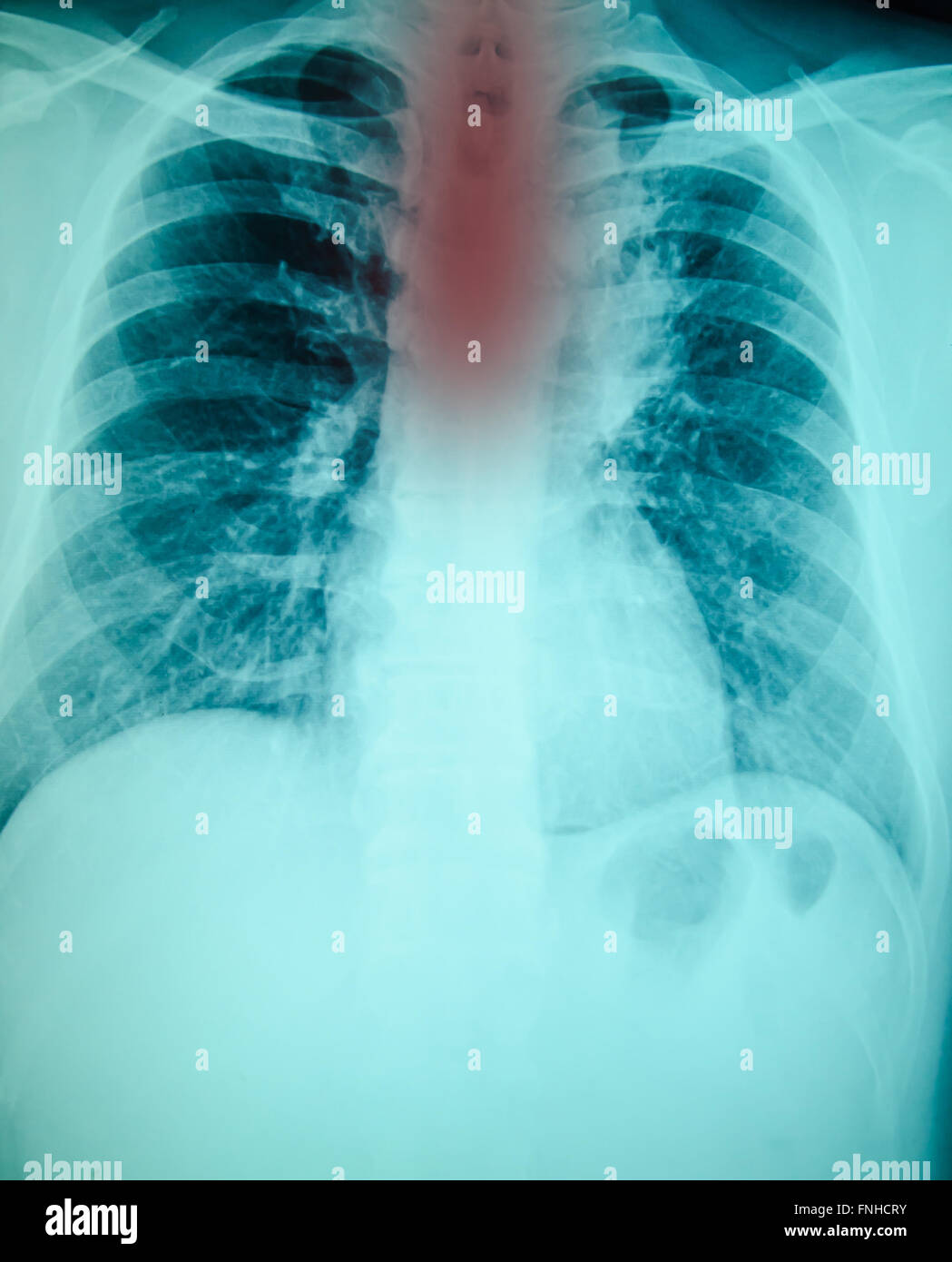 Radiographie du rachis et de l'examen pour le diagnostic des blessures ...