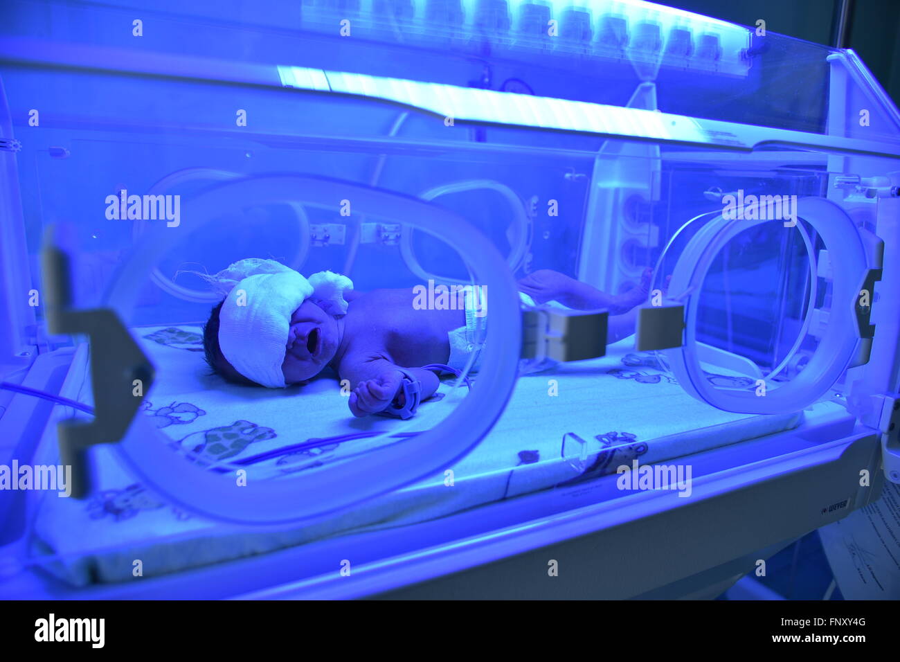 Phototherapy baby Banque de photographies et d’images à haute ...