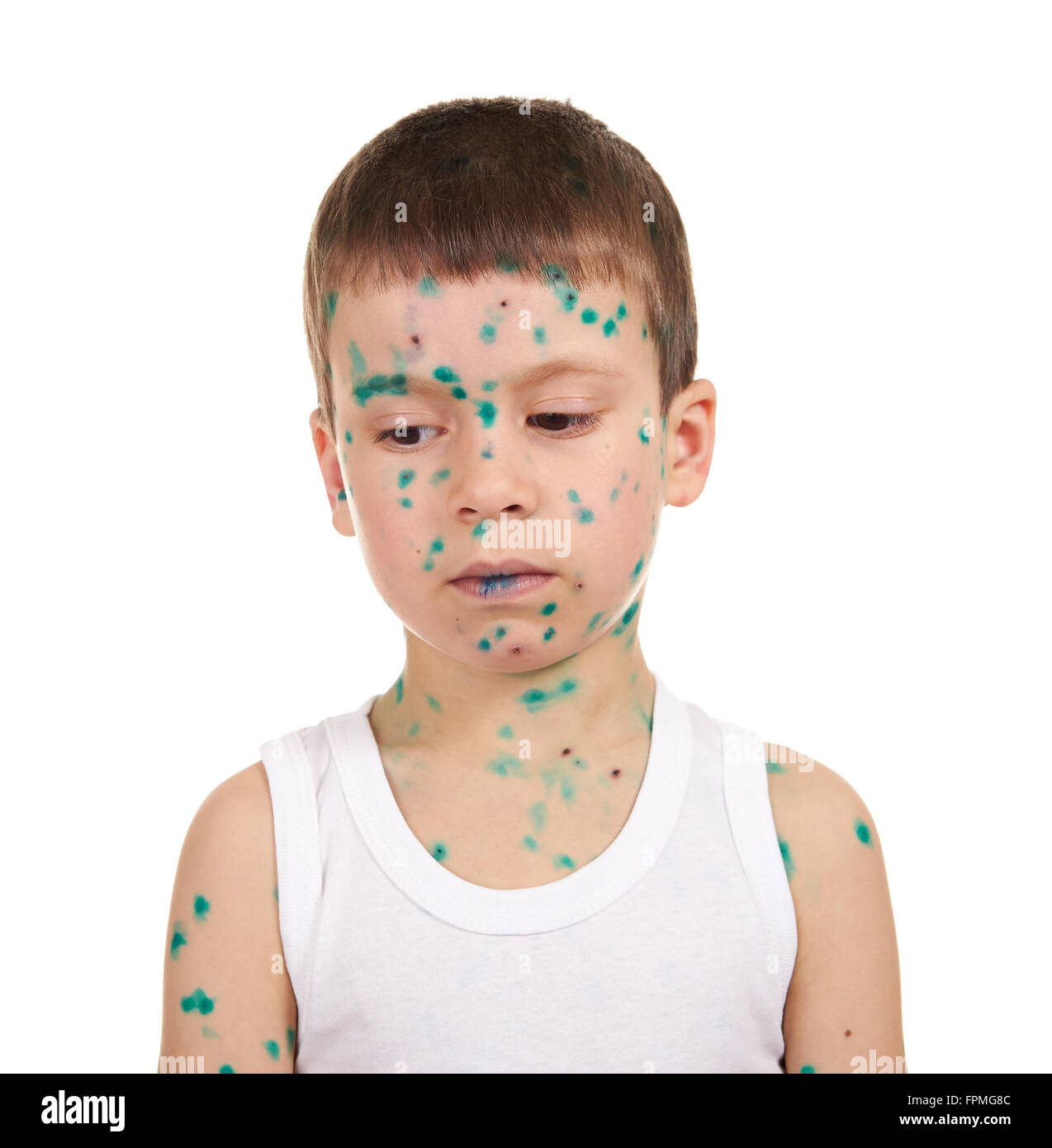 Enfant malade a le virus sur la peau Banque de photographies et d ...