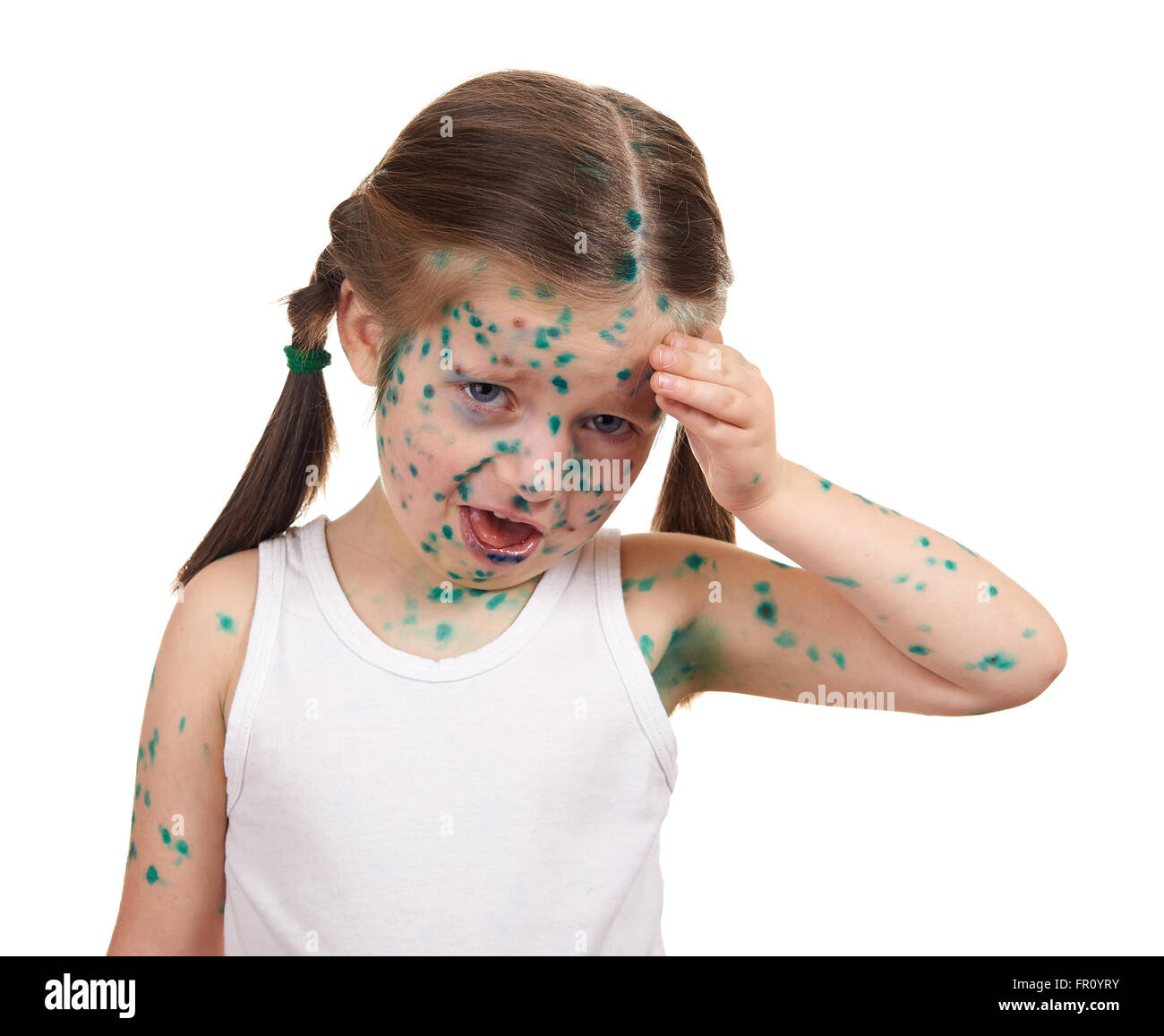 Enfant malade a le virus sur la peau Banque de photographies et d ...