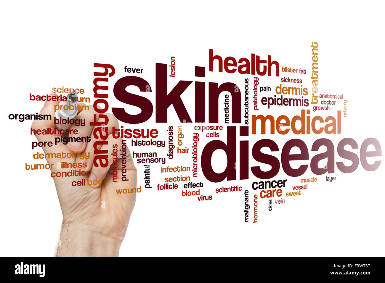 Maladie de peau Banque de photographies et d’images à haute résolution ...