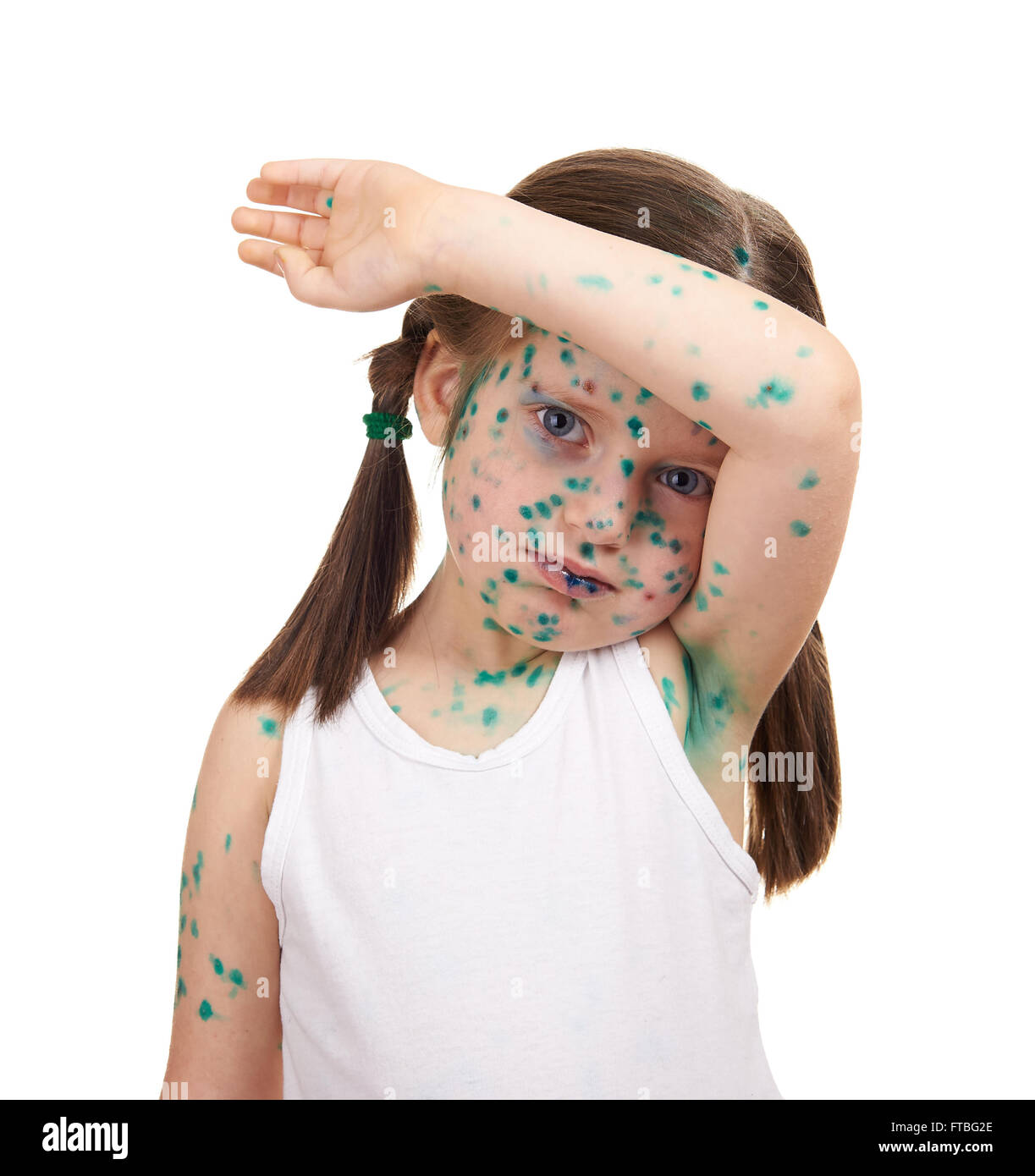 L'enfant malade a le virus sur la peau Photo Stock - Alamy