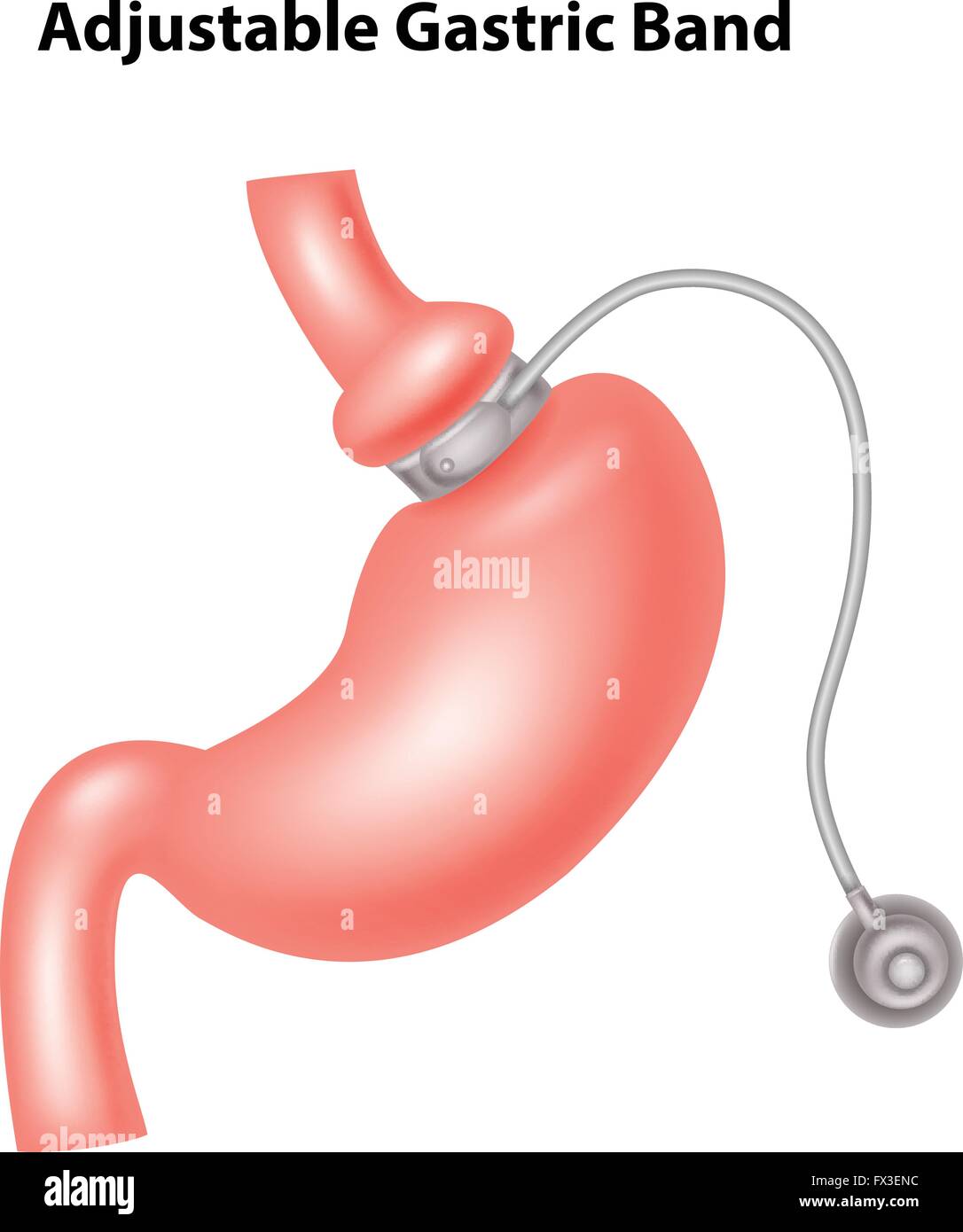 Poche gastrique Banque de photographies et d’images à haute résolution - Alamy