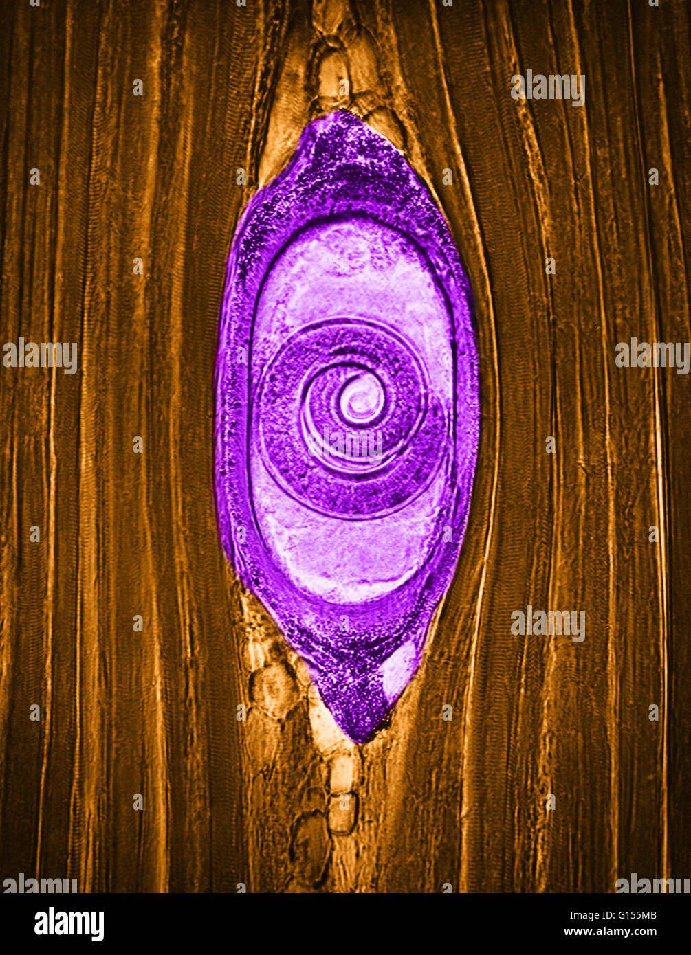 Micrographie de lumière avec muscle Trichinella spiralis enkystées ...