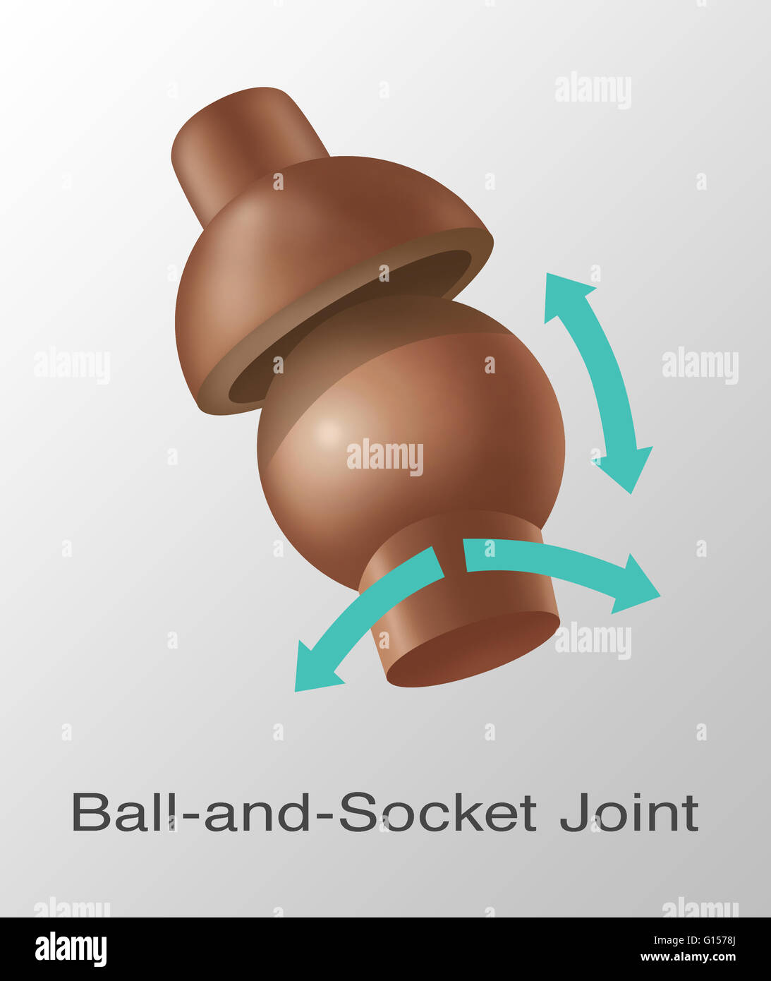 Remplacement de l'articulation de la cheville Banque de photographies ...